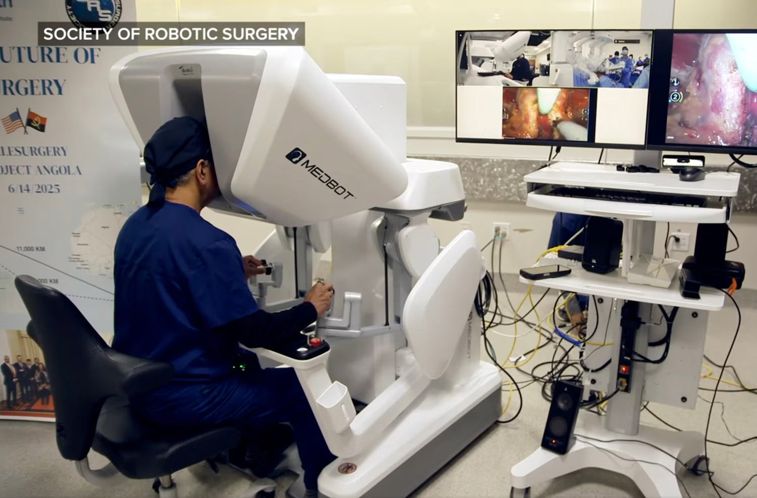 Fellow Leads Groundbreaking Prostatectomy on Patient 7,000 Miles Away | ACS