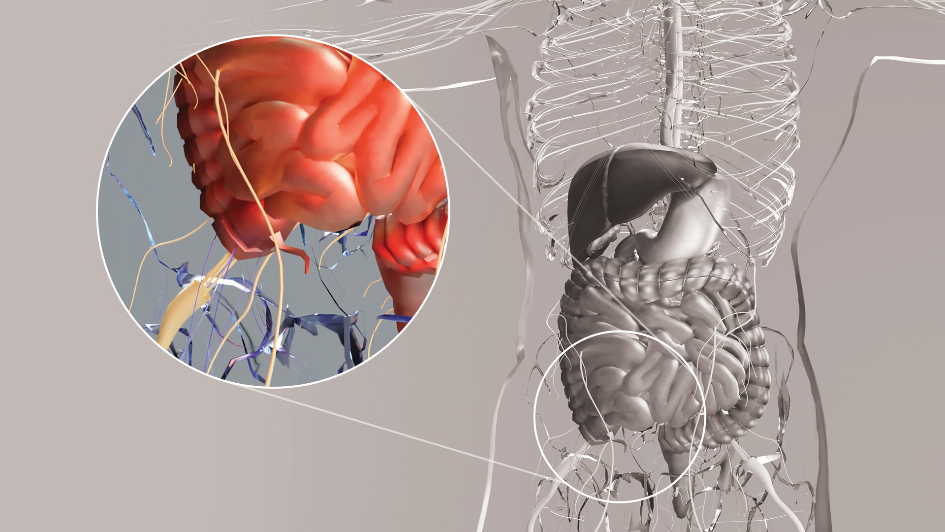 Are Antibiotics the Answer to Treating Appendicitis? | ACS