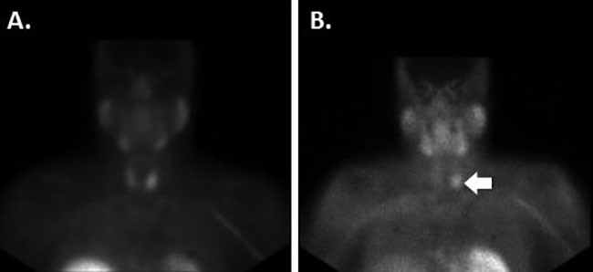 The "No-Zone" Approach to Penetrating Neck Trauma | ACS