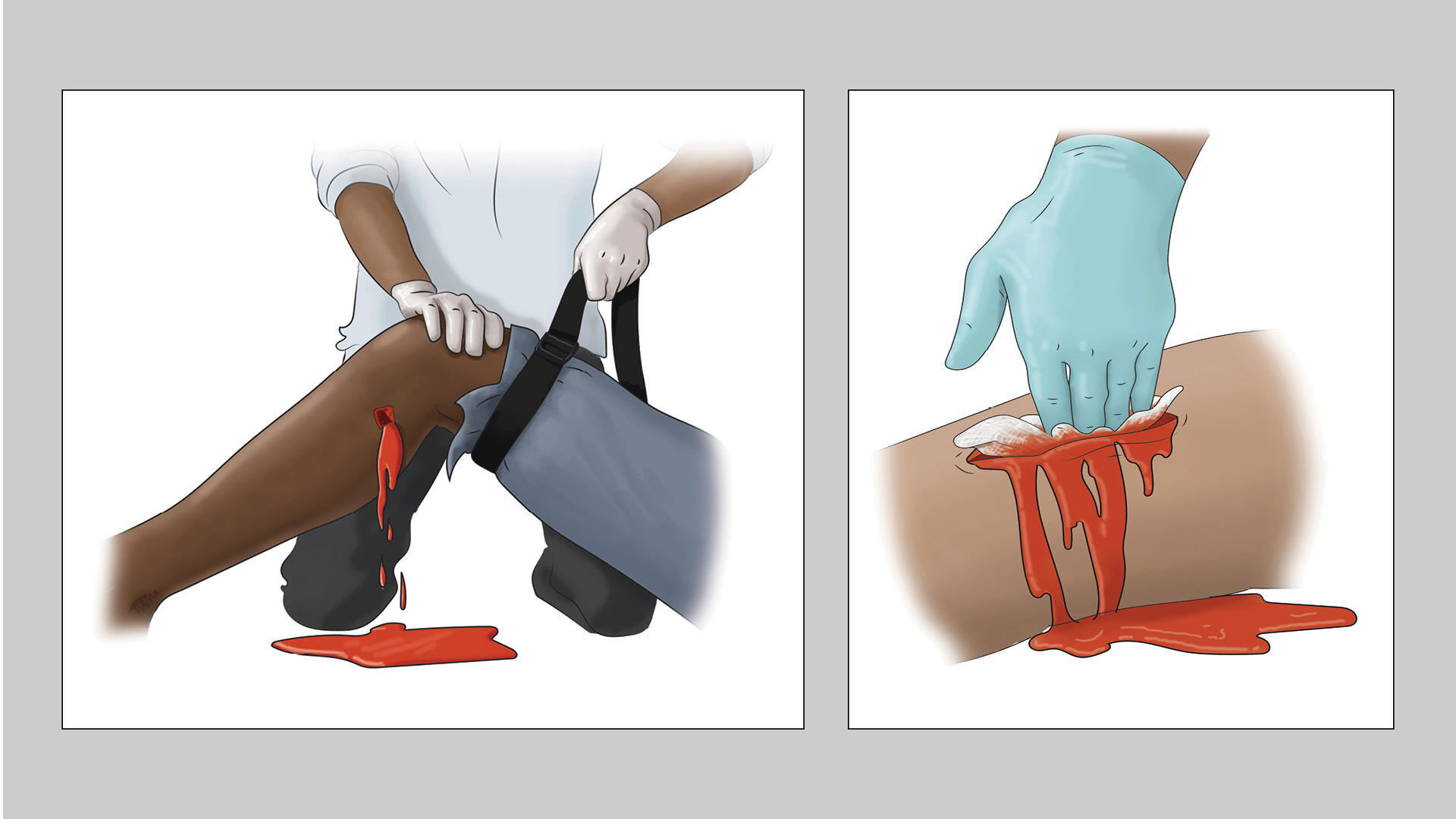 Trauma Meeting Spotlights New Image-Focused STOP THE BLEED Course | ACS