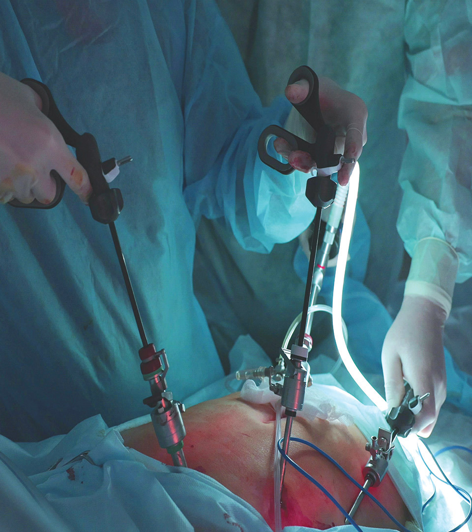 Conversations in Acute Cholecystitis Management Include Treatment ...