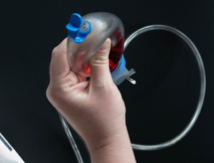 Your Surgical Drain | ACS