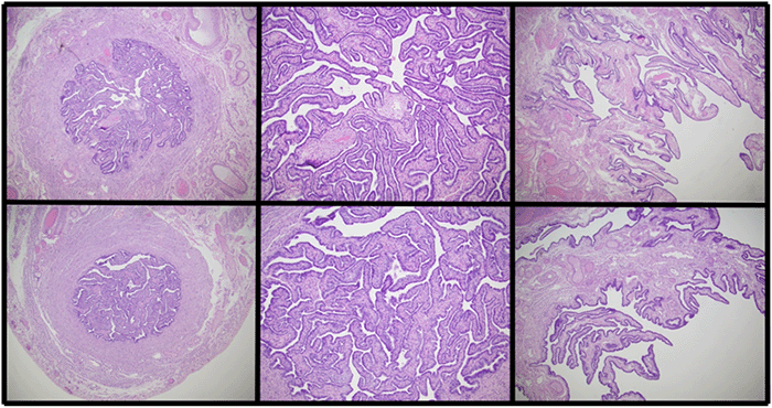 Ischemic Fallopian Tube: Uncommon Femoral Hernia Contents during ...