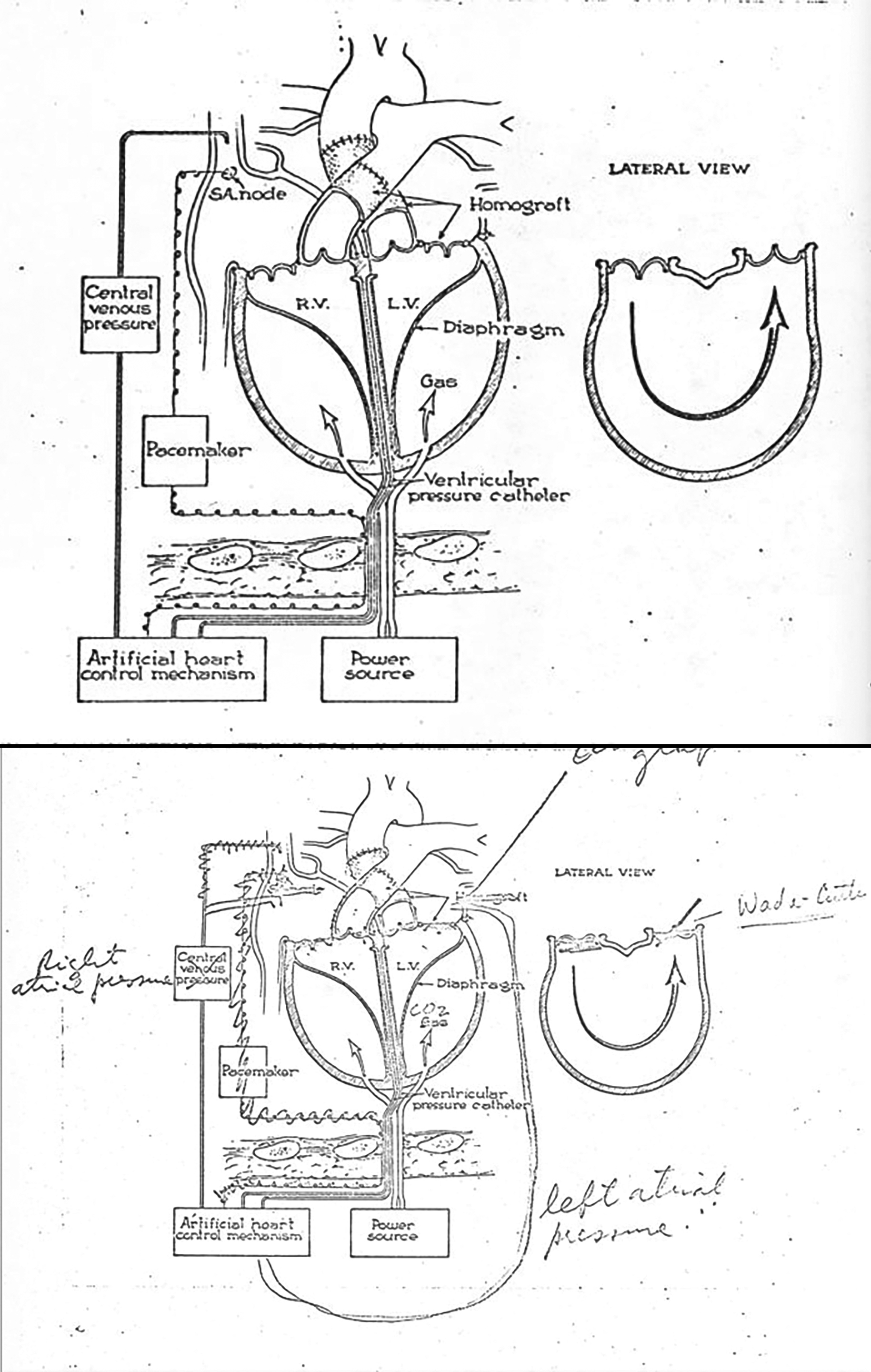 Stolen Heart: DeBakey-Cooley Controversy Beats On | ACS