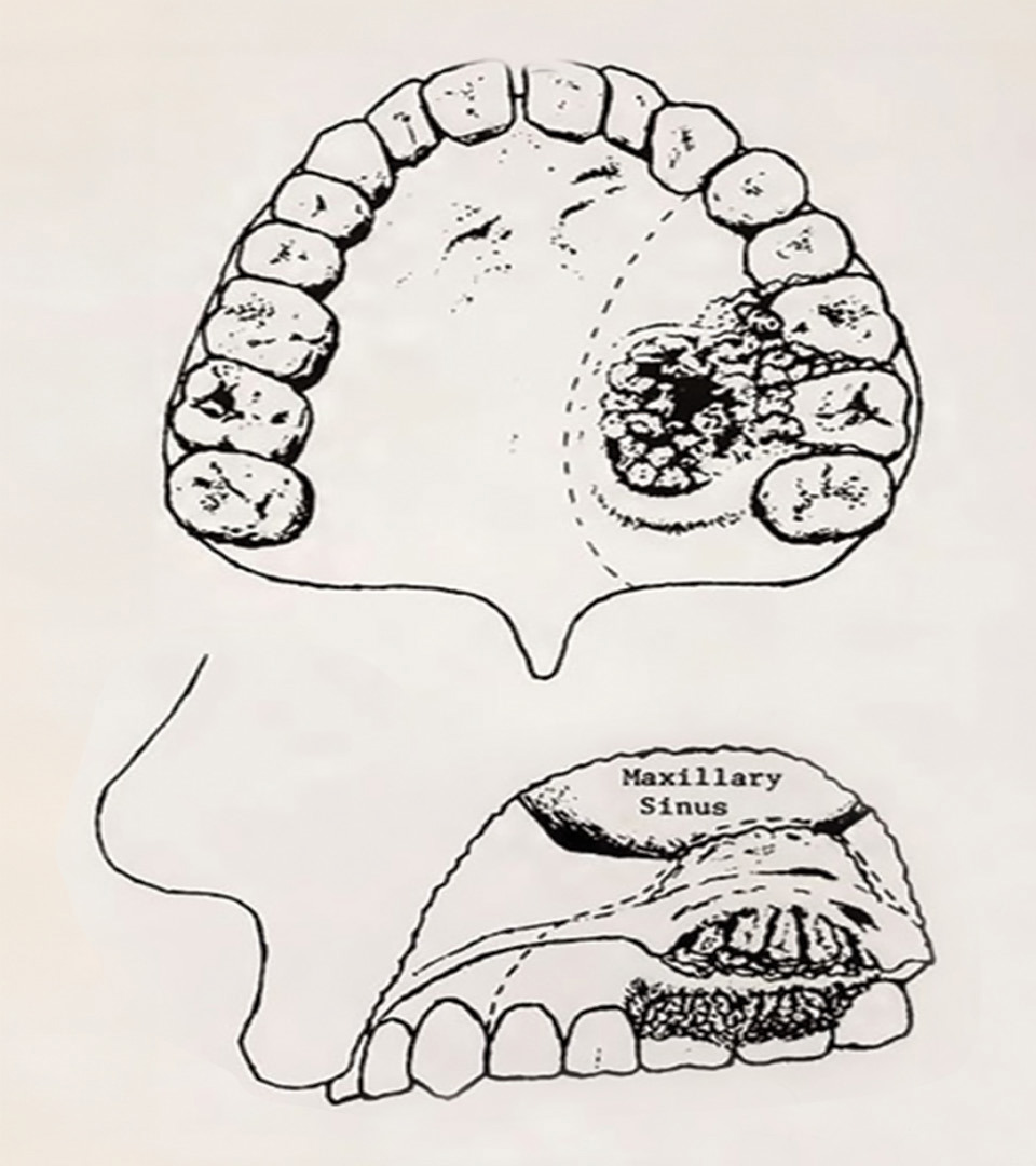 Surgeries of US Presidents Reveal History of Secrecy and Scrutiny | ACS