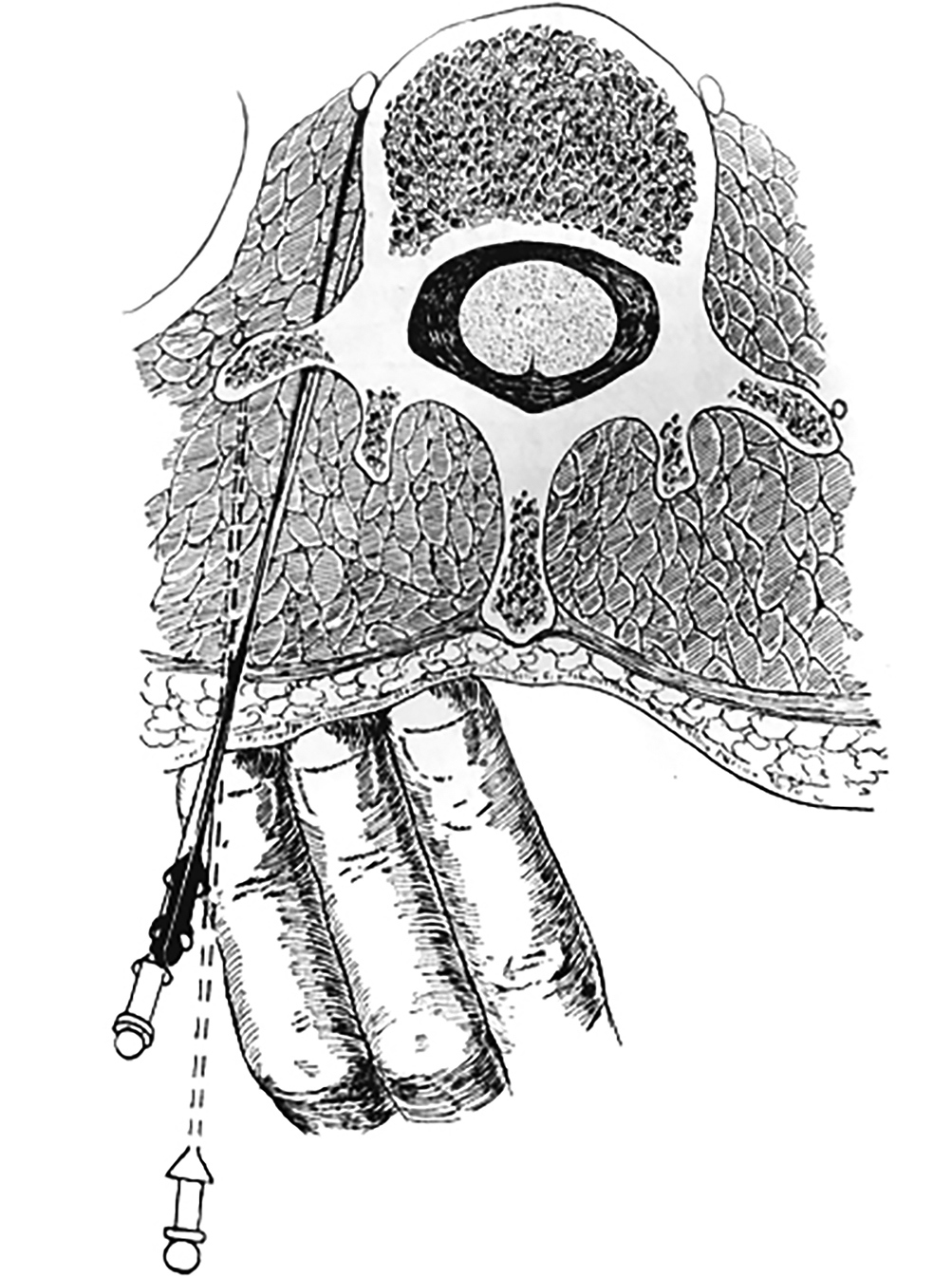 Sympathectomy Has Two-Decade Prominence in Treating Peripheral Arterial ...