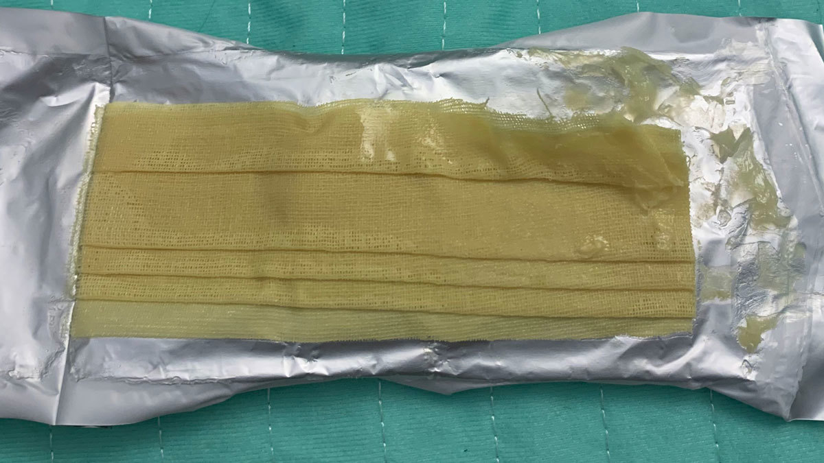 Surgical Wound Care | ACS