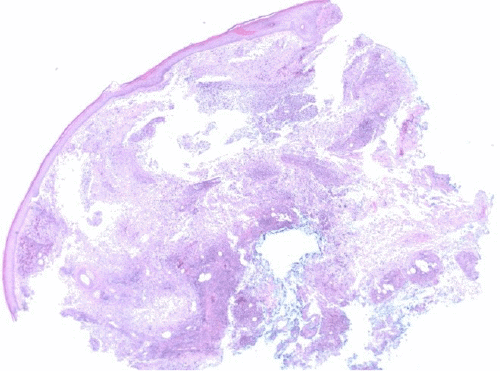 A Surgeon, a Dermatologist, and a Rheumatologist Walk into a Bar ...