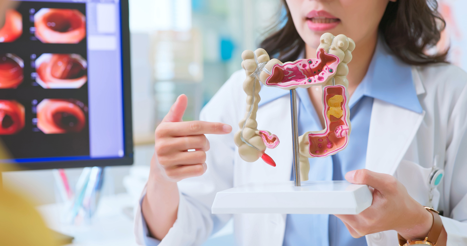 Colorectal Cancer | ACS