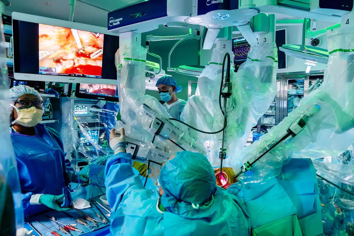 ACS Fellow Leads World’s First Fully Robotic Double Lung Transplant | ACS