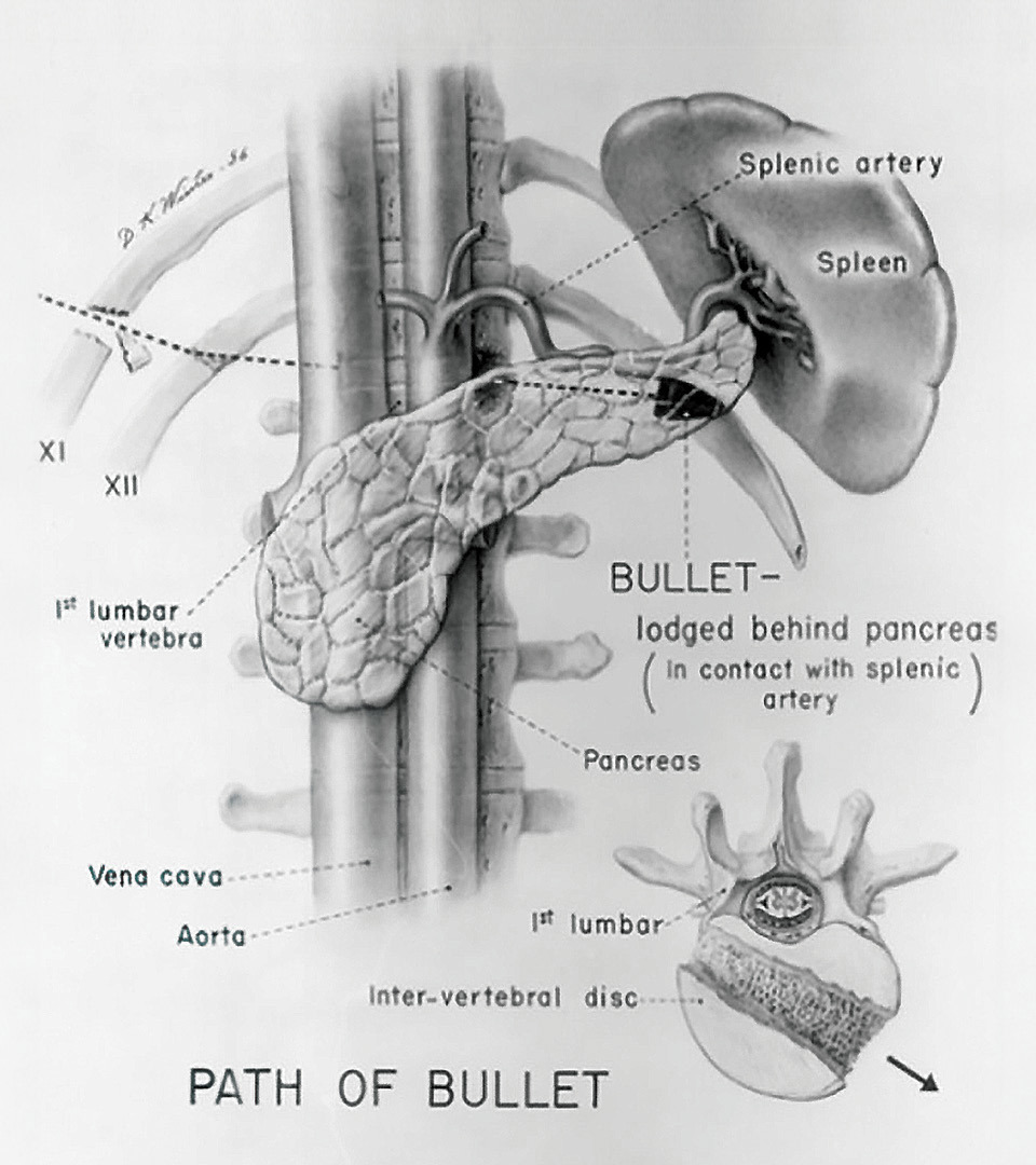 Surgeries of US Presidents Reveal History of Secrecy and Scrutiny | ACS