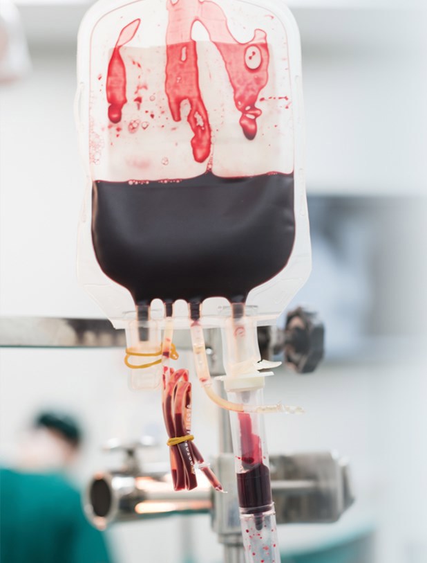 Platelet Transfusion